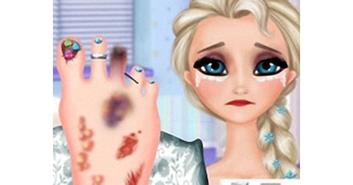 Elsa Foot Injured - Play Elsa Foot Injured Game Online Free