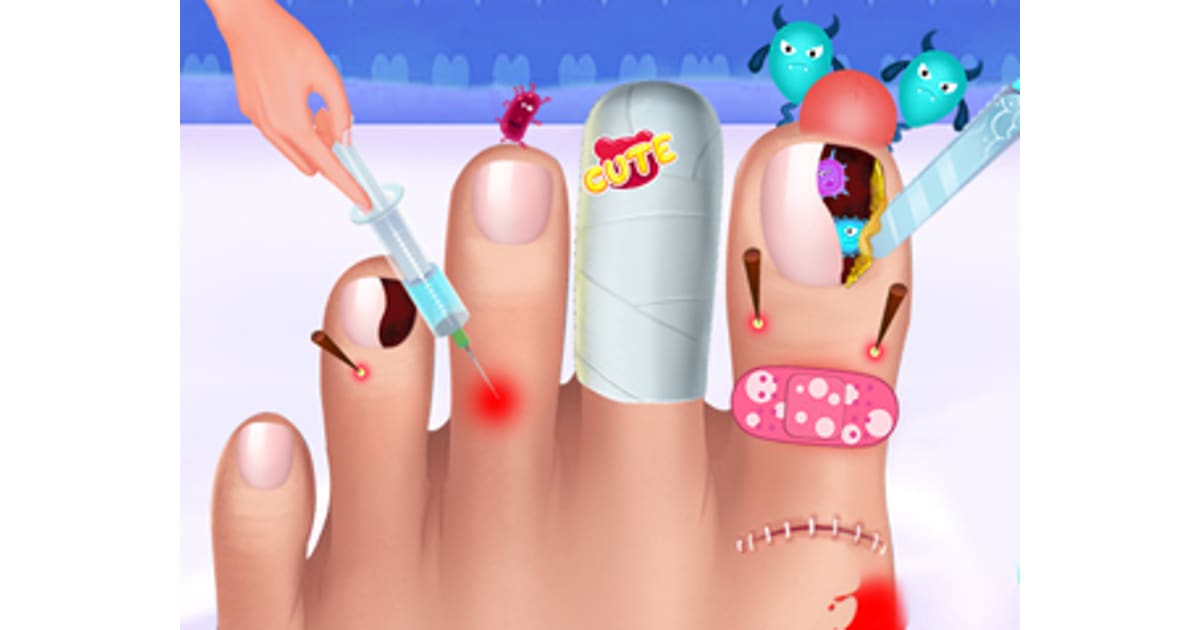 Nail Doctor - Play Nail Doctor Game Online Free